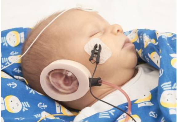 Sera™ | How to do Automated ABR | Interacoustics